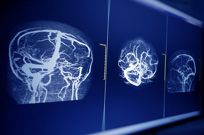 Northwestern Medicine Revolutionizes Neurosurgery with Innovative ...